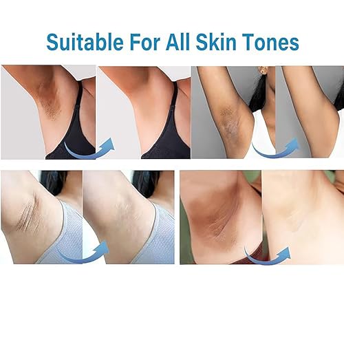 Skin Lightening Cream For Dark Underarm , Knees , Elbows , Inner Thigh , Bikini Line , Armpit Area Bleaching cream,Permanent Whitening No Rebound , Spot Remover Lighten Body Black Designed by USA