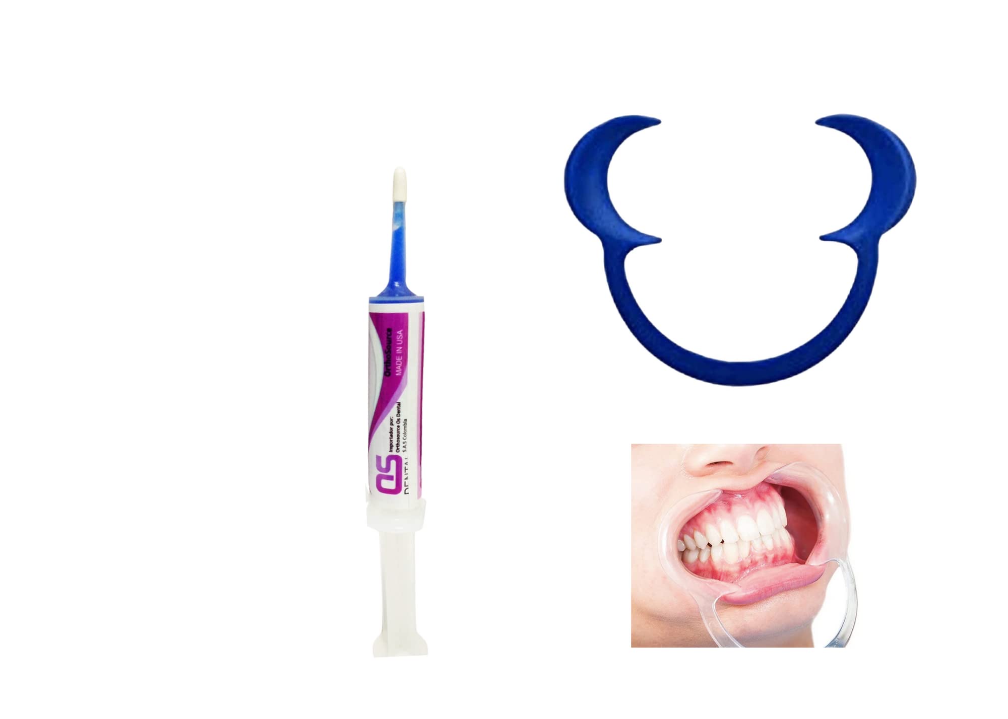 SmileWorld Blue Gel 36 Gm kit - Desmineralization Gel 35 Percent -Dental Etch - Perfect Viscous-Stays Where Placed- Includes Lip Expander - Not Glue - Made in USA (3) Units