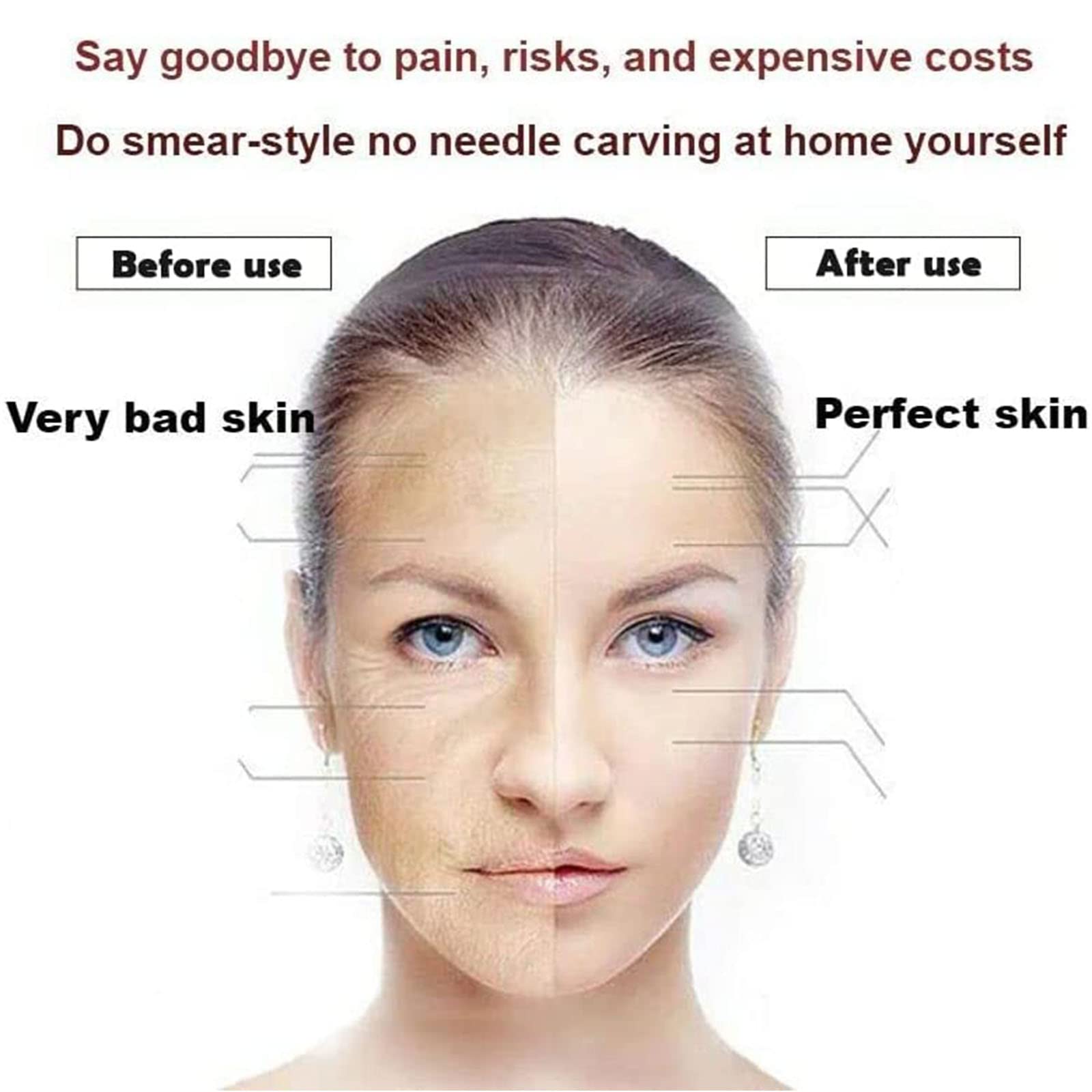 Soluble Protein Thread Lifting, Instant Face Protein Thread, 12Line/Bag Firming Lifting Skin Care(15 Bag)