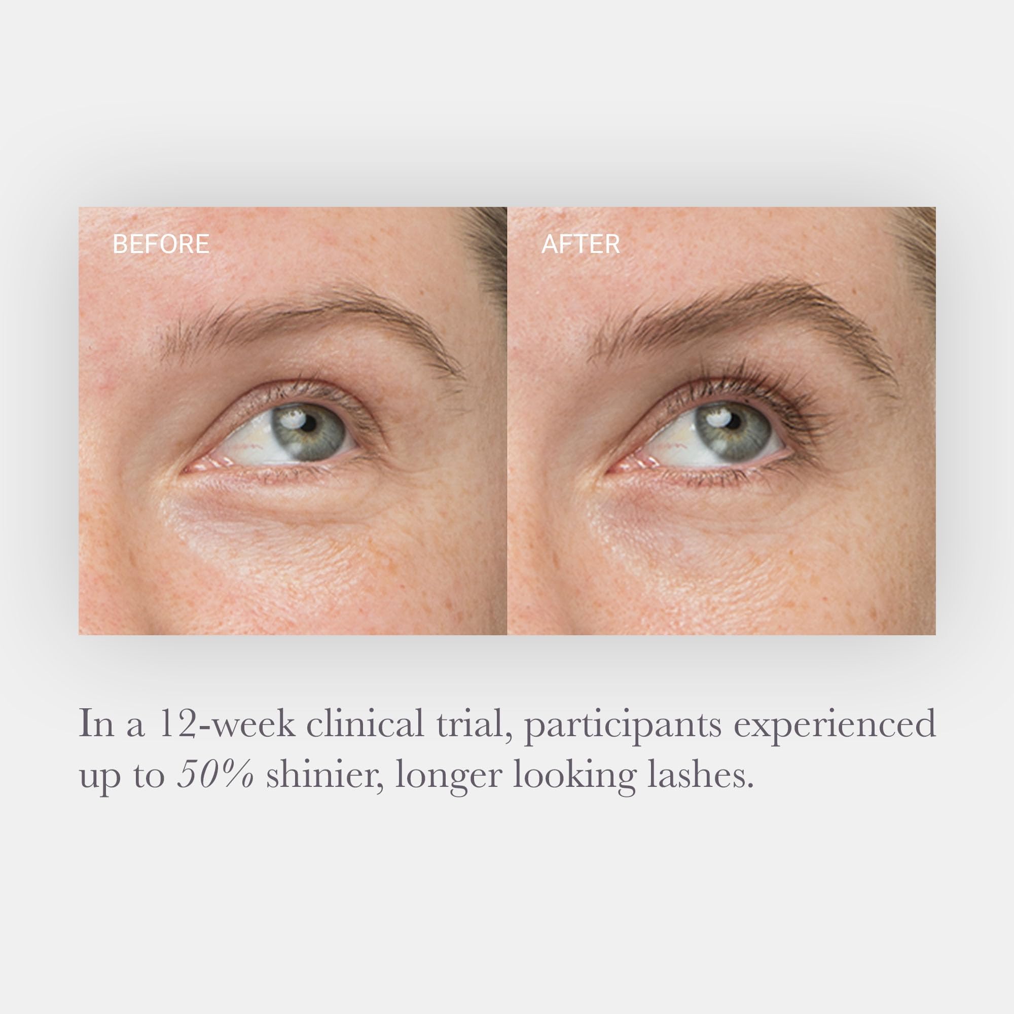 NULASTIN LASH Follicle Fortifying Serum with Elastaplex, Eyelash Boosting Treatment for Longer Looking Lashes, Vegan-Friendly & Cruelty-Free (3 ml)
