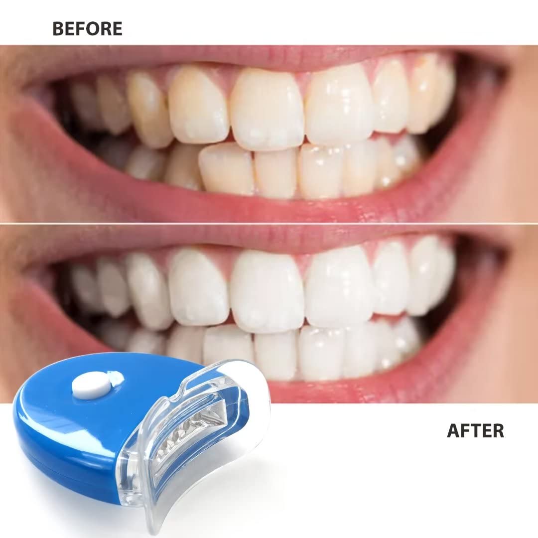 Teeth Whitening Kit (10) Gel (2) Trays (1) White LED Light Best Dental 44% Lightens Teeth Dramatically and Safely