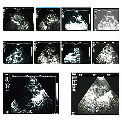 Veterinary Ultrasound Scanner, Livestock HD Pregnancy Tests Machine, 4 Kinds of Pseudo Color, 5.6 Inch Color Screen, Waterproof Probe, for Pig and Sheep Pregnancy (3.5mhz Convex Array Probe)