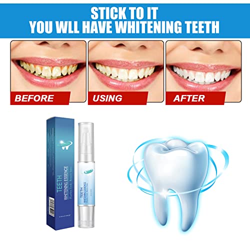 Store Belly Teeth Whitening Essence, Teeth Whitening Essence Pen, Teeth Whitening Gel, Teeth Whitening Kit, Fast and Effective Removal Tooth Stain Removal