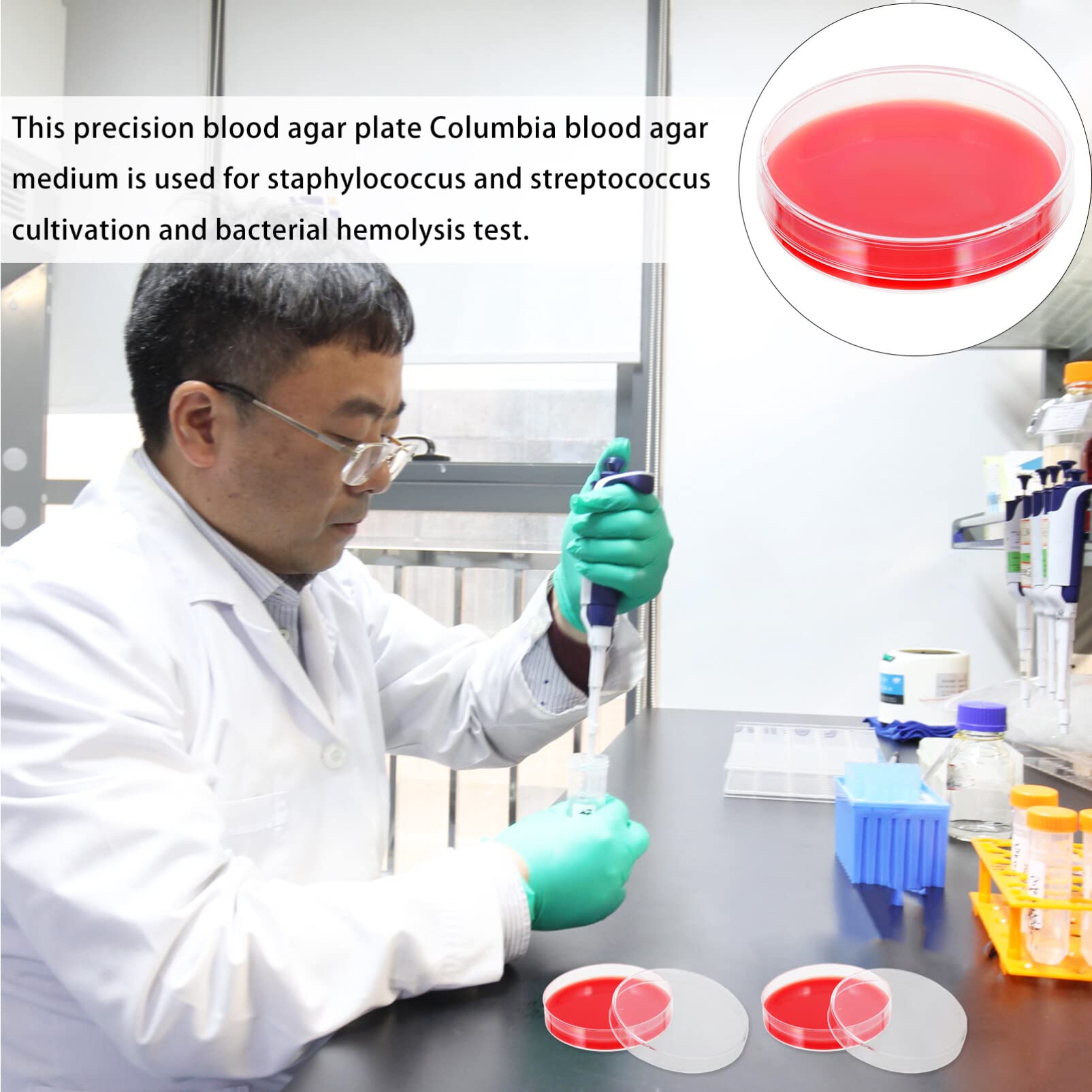 VILLCASE Blood Agar Plates, Blood Agar Medium Biological Determine Equipment, Lab Petri Dishes Blood Agar Plates Culture Dishes for Cultivation of Microorganisms