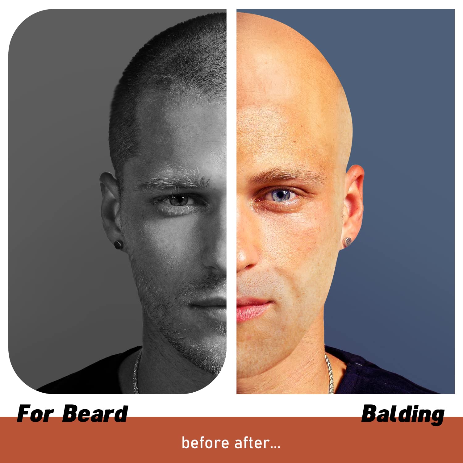 SUPRENT Professional Hair Clippers and Foil Shaver for Men