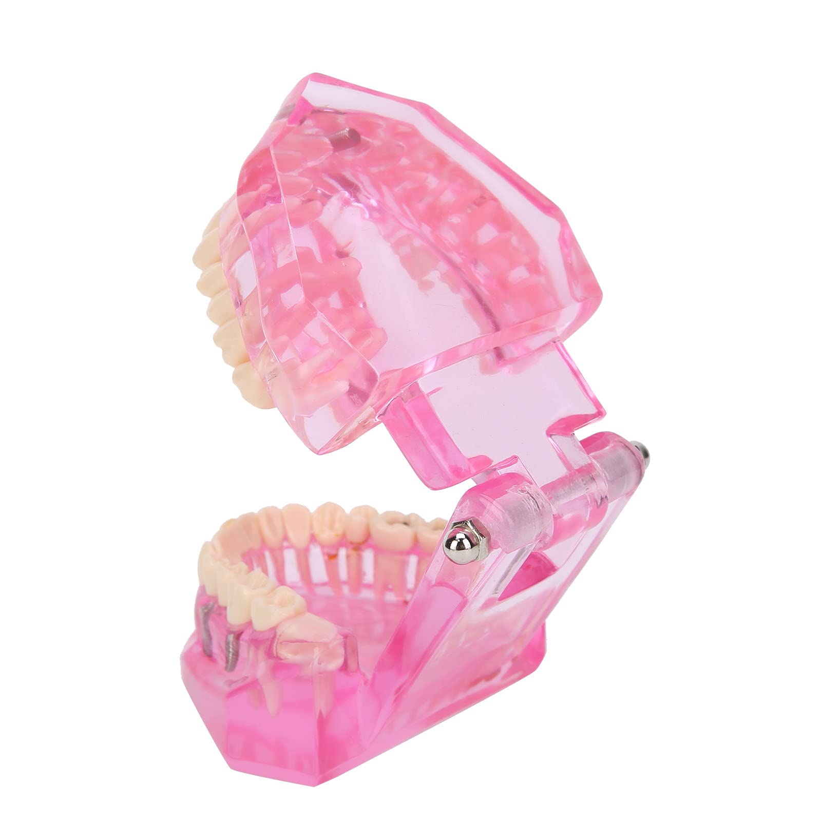 Transparent Adult Teeth Model ,Pathological Removable Teach Repair Studying Dental Teaching Tools Standard Size