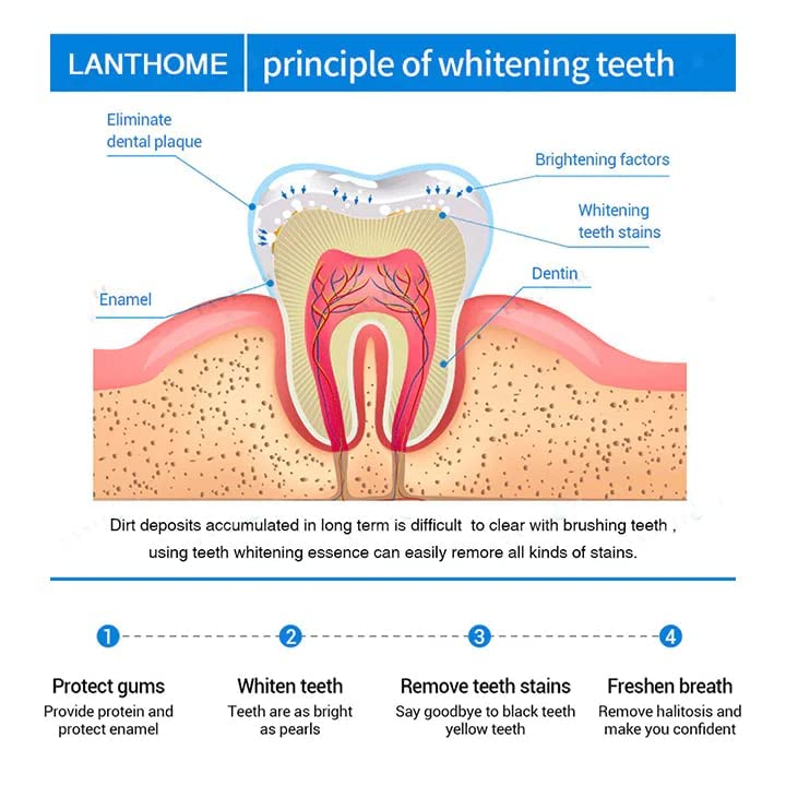 Teeth Whitening Essence, Teeth Whitening Essence Pen,Intensive Stain Removal Teeth Reduce Yellowing