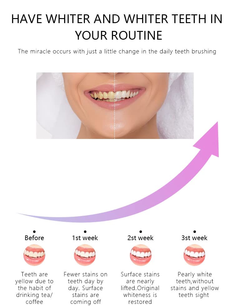 Teeth Whitening Strips for Non-Sensitive Professional Effect Teeth Whitening of 28 Whitener Strips (14 Treatments) (White Transparent)