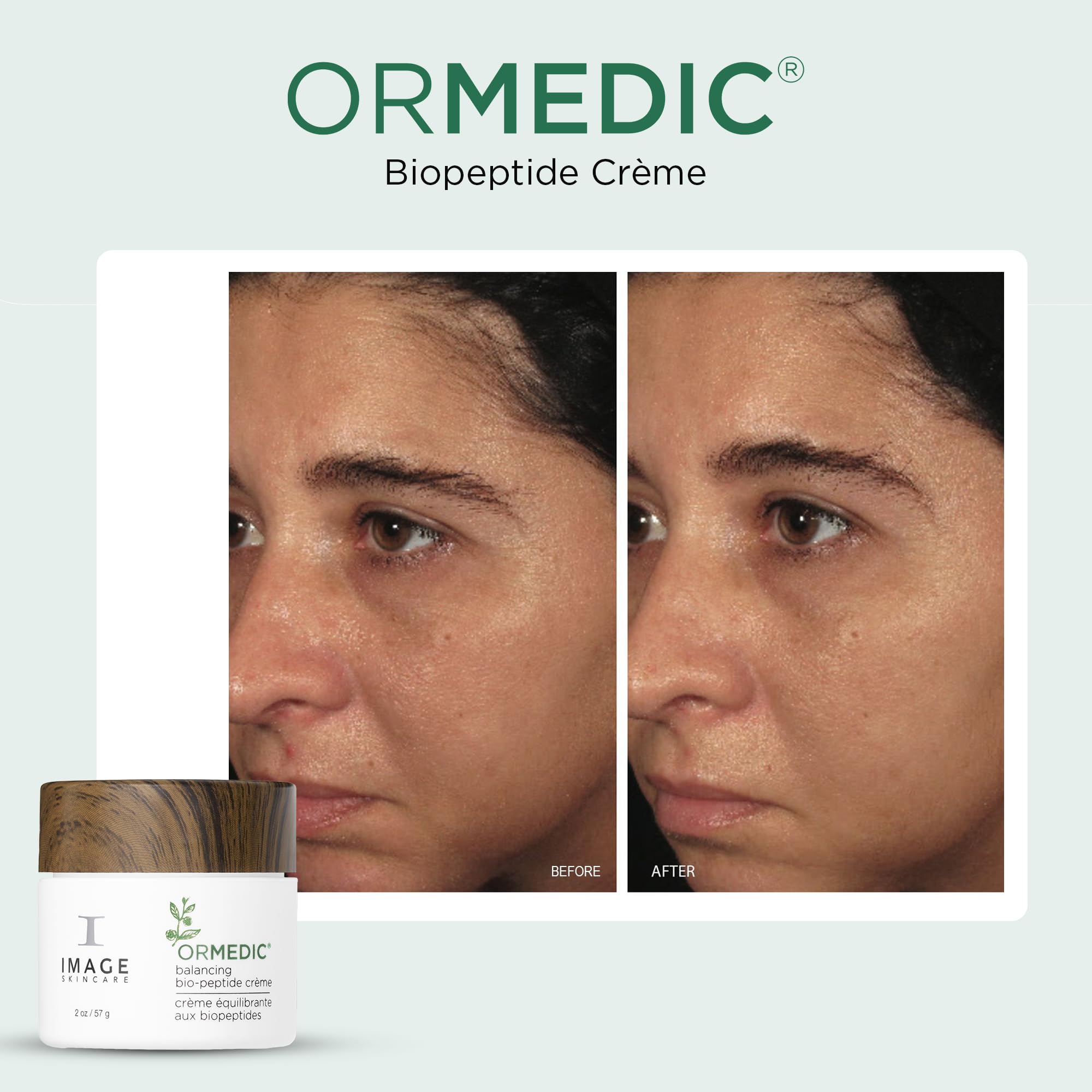 IMAGE Skincare, ORMEDIC Biopeptide Crème, Balancing Face Moisturizer with Shea Butter, Hyaluronic Acid and Organic Plant Oils, 2oz