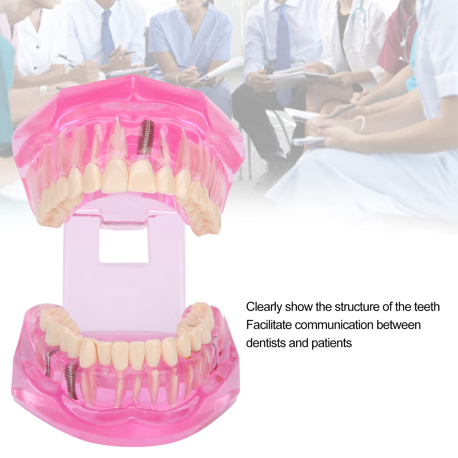 Transparent Adult Teeth Model ,Pathological Removable Teach Repair Studying Dental Teaching Tools Standard Size