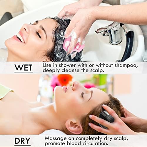 Sosoon Scalp Massager Shampoo Brush, Soft Silicone Hair Scalp Exfoliating Scrubber for Men Women Kids Hair Growth(Black and Dark Blue)