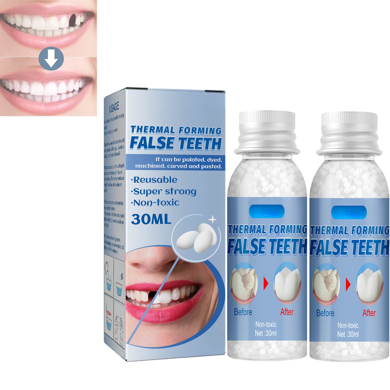 Tooth Repair Kit, Tooth Repair Granules, Nano-Molecule Teeth Filler Glue, Temporary Tooth Filling Kit for Temporary Restoration of Missing & Broken Teeth (2PC)
