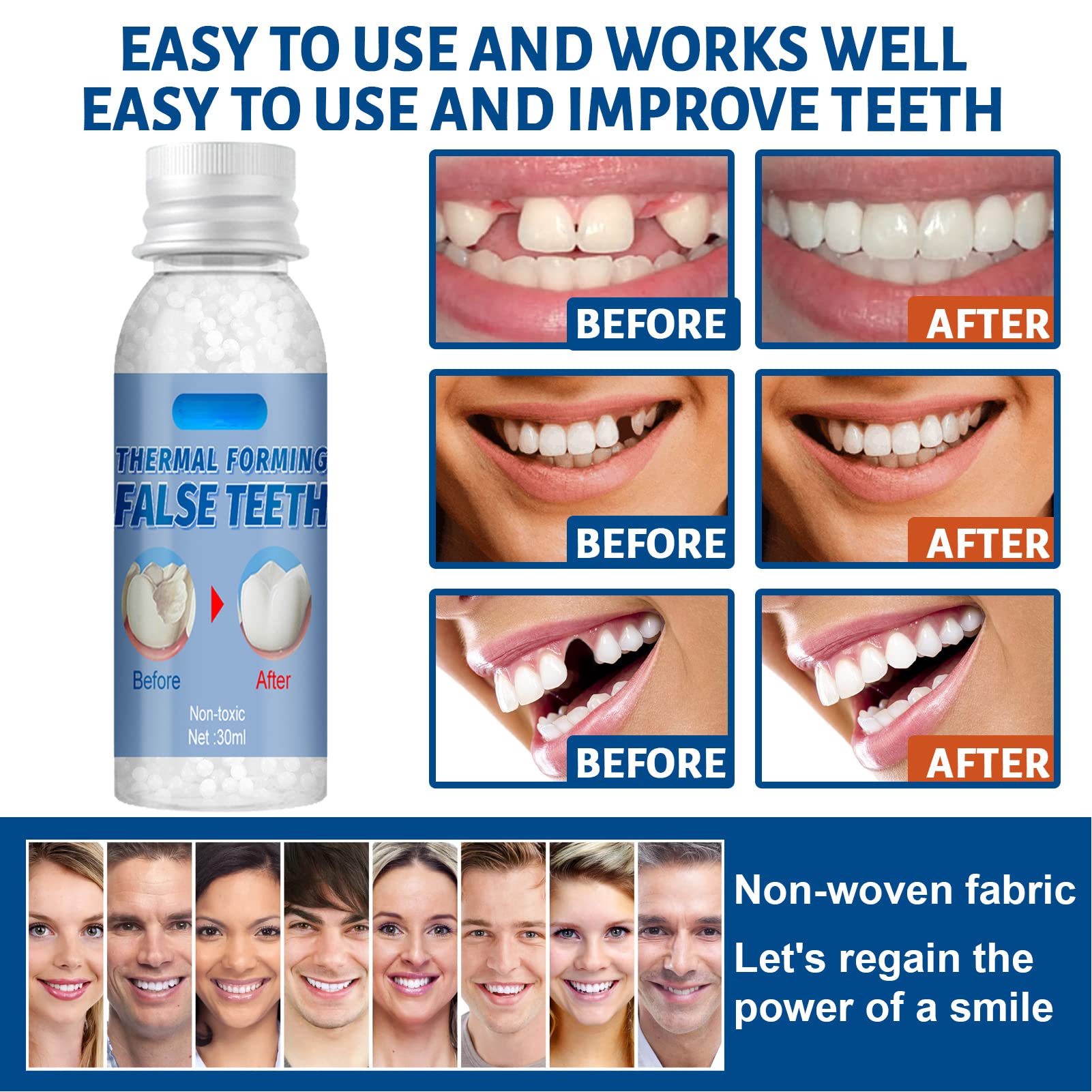 Tooth Repair Kit, Tooth Repair Granules, Nano-Molecule Teeth Filler Glue, Temporary Tooth Filling Kit for Temporary Restoration of Missing & Broken Teeth (2PC)