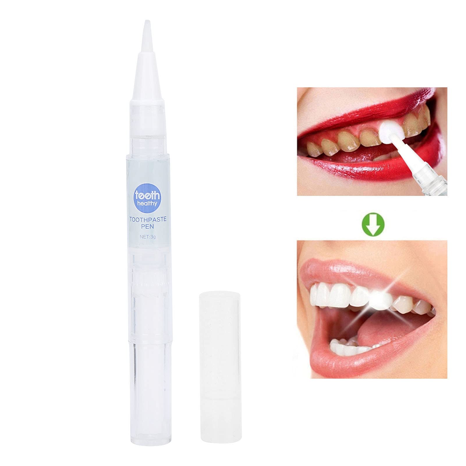 Teeth Whitening Pen, Teeth Whitening Pen