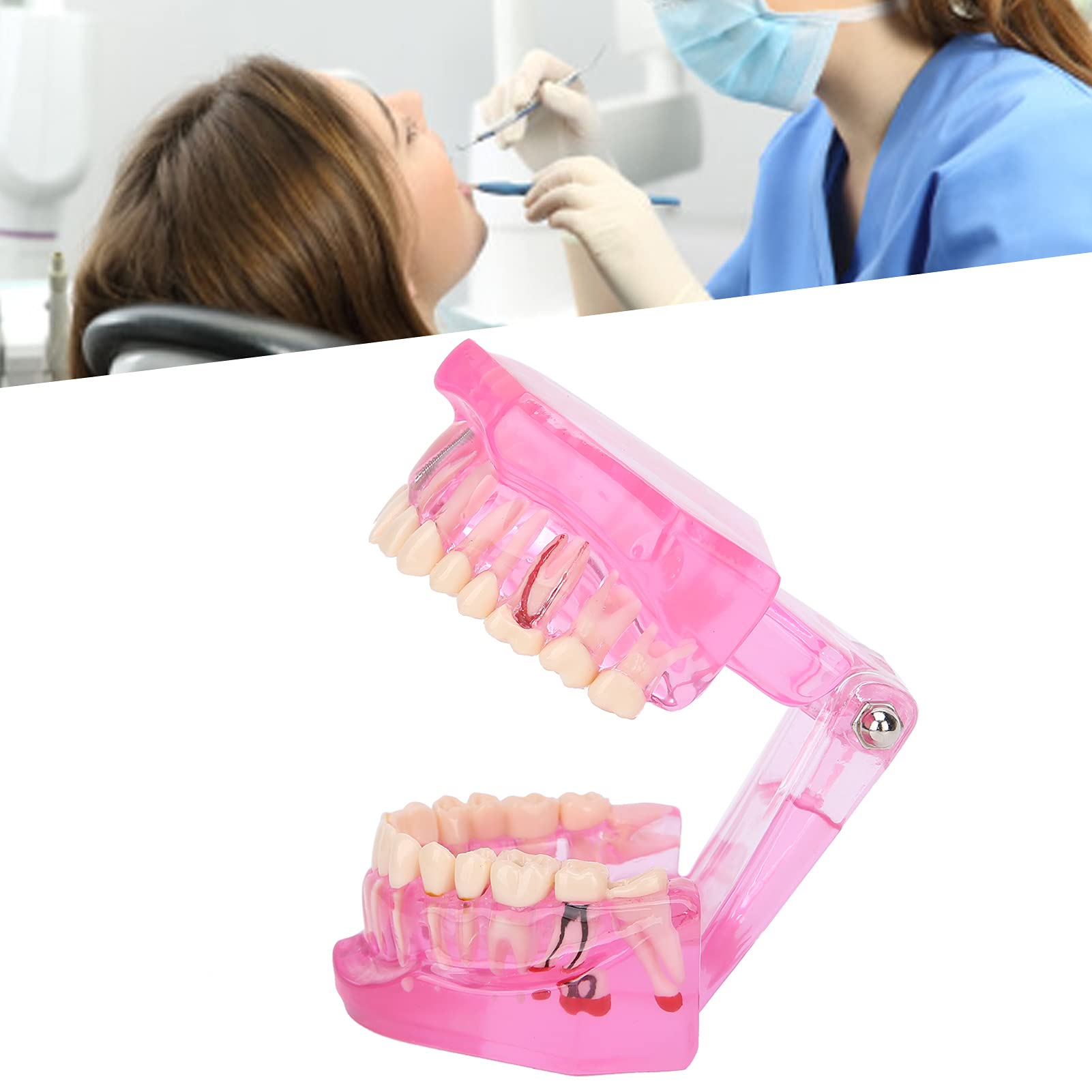 Transparent Adult Teeth Model ,Pathological Removable Teach Repair Studying Dental Teaching Tools Standard Size