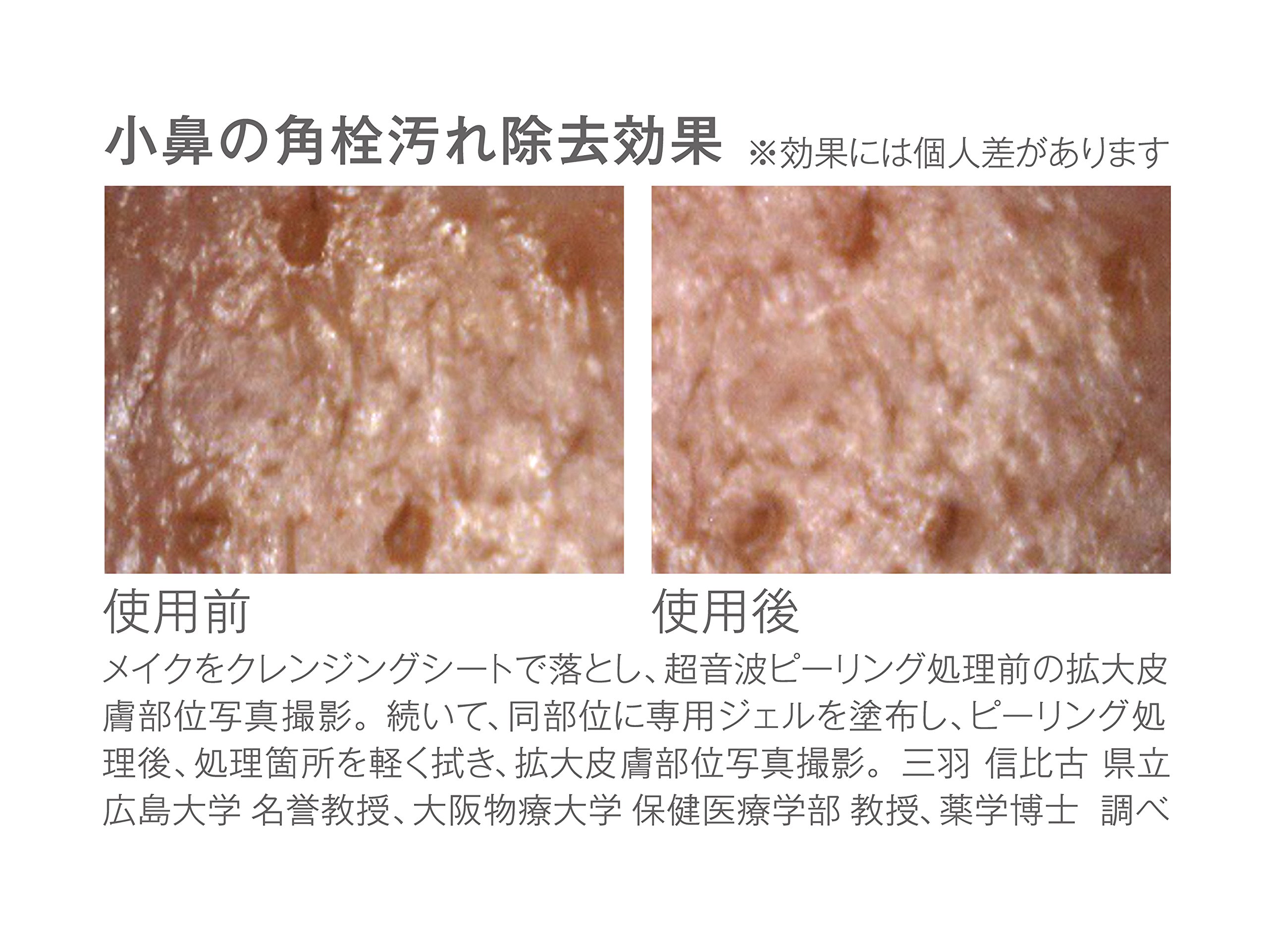 KOIZUMI Bijouna [horny pores care ultrasonic peeling KBE-2700 / P
