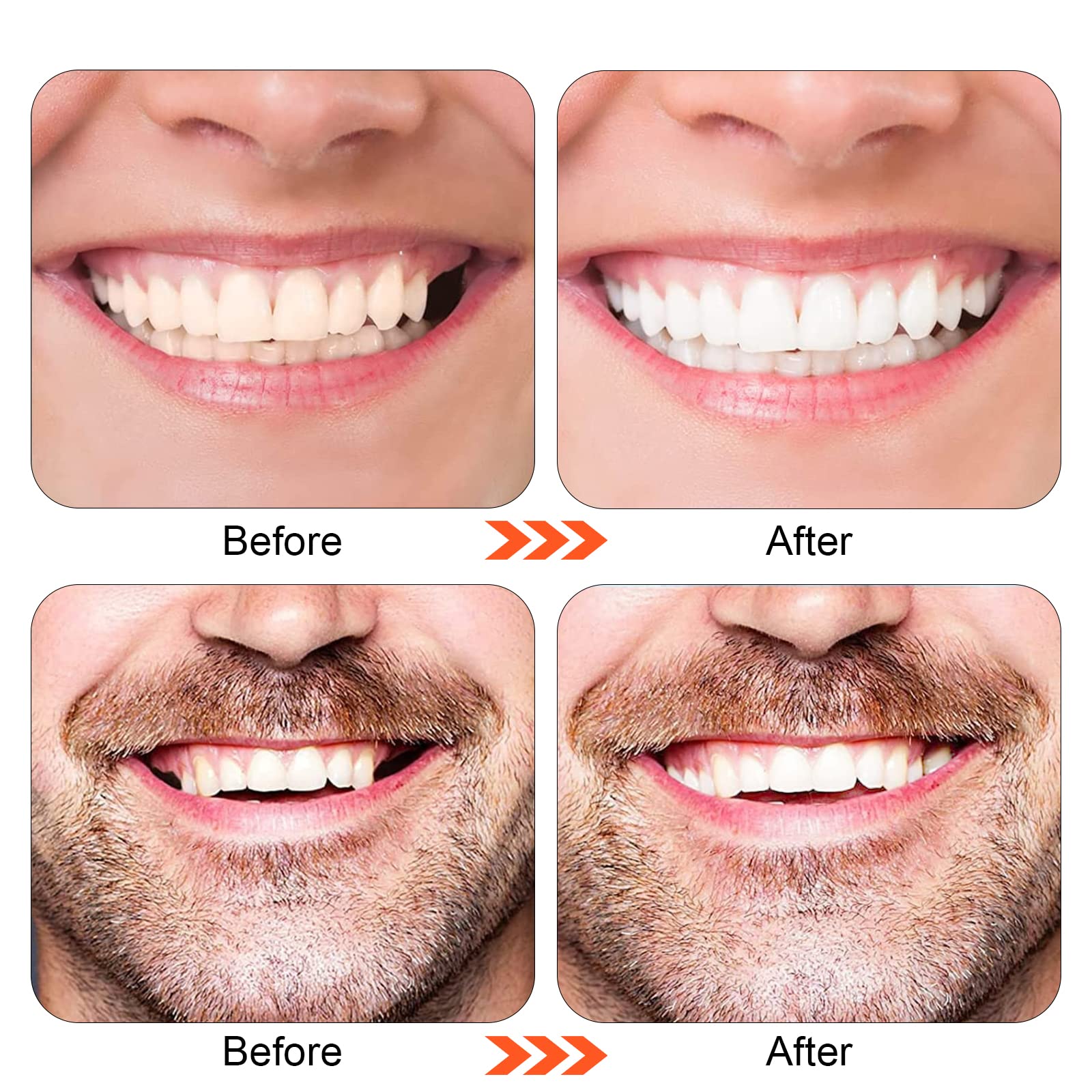 Tooth Repair Kit,Moldable Thermal Fitting Bead Teeth Pellet Adhesive Fake Teeth for Halloween Scary Themed Party Makeup Filling Fix The Missing Broken Tooth(6pcs),D