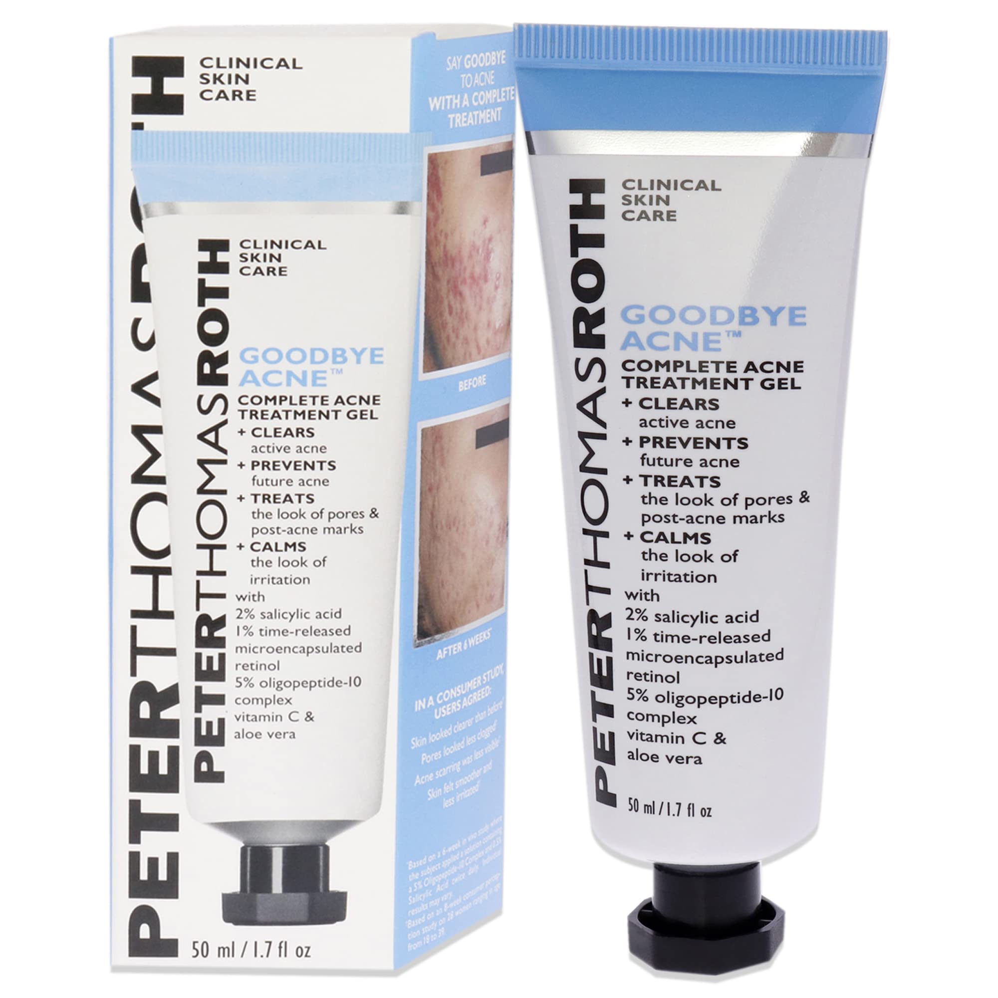 Peter Thomas Roth | Goodbye Acne Complete Acne Treatment | Gel to Clear, Prevent, Treat and Calm Acne, Post Acne Mark Treatment