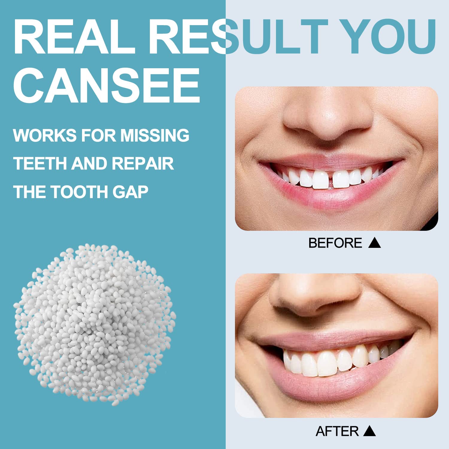 Temporary Tooth Repair kit for Filling The Missing Broken Tooth and Gaps-Moldable Fake Teeth and Thermal Beads Replacement Kit
