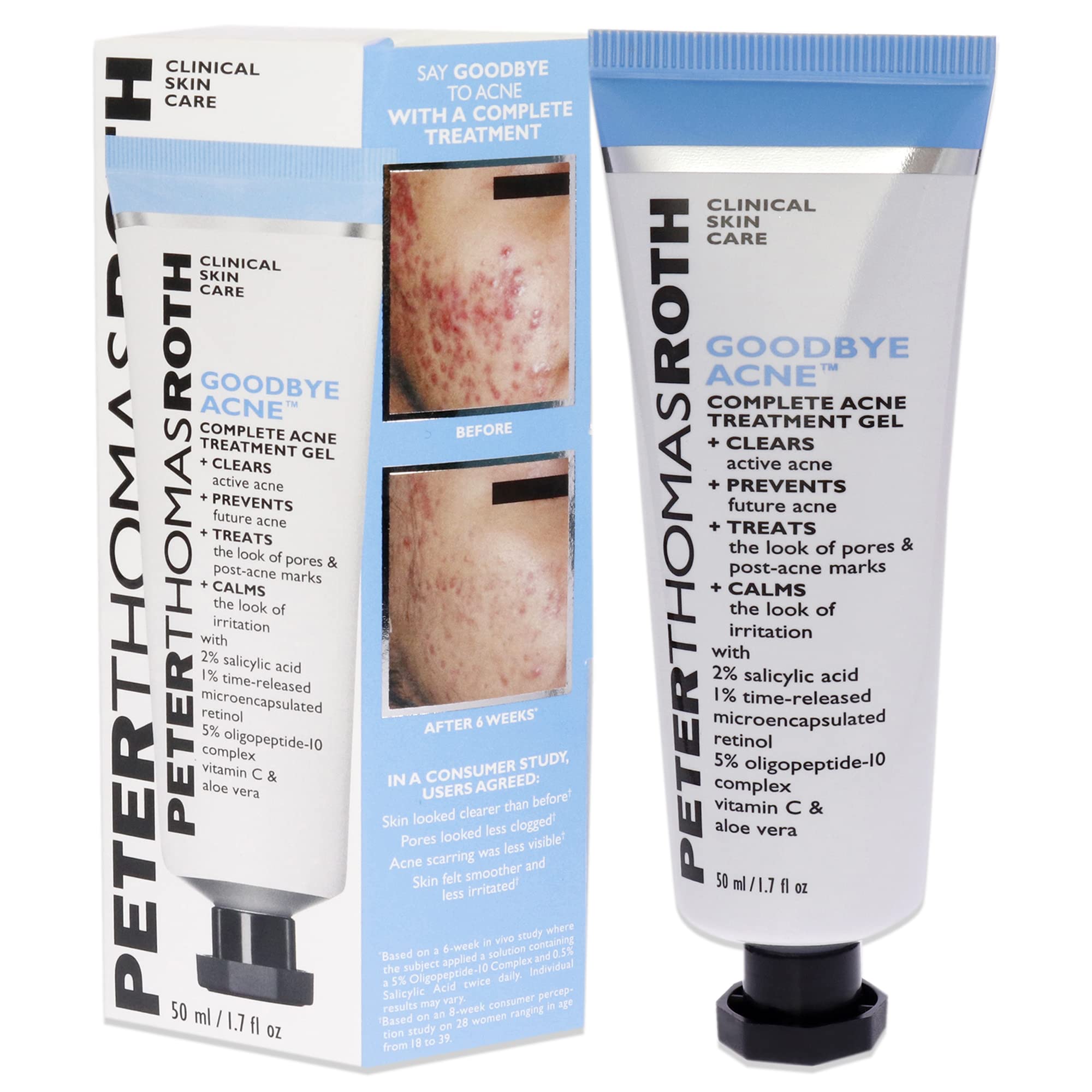 Peter Thomas Roth | Goodbye Acne Complete Acne Treatment | Gel to Clear, Prevent, Treat and Calm Acne, Post Acne Mark Treatment