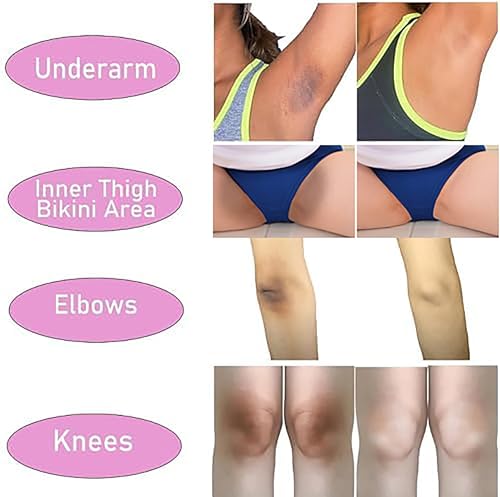 Skin Lightening Cream For Dark Underarm , Knees , Elbows , Inner Thigh , Bikini Line , Armpit Area Bleaching cream,Permanent Whitening No Rebound , Spot Remover Lighten Body Black Designed by USA