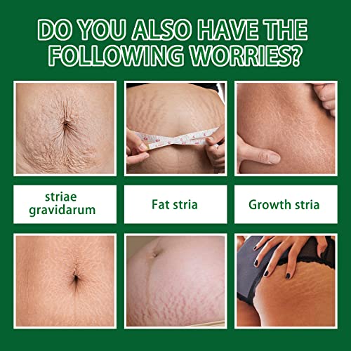 Vintners Daughter Stretch Marks Removal Spray Stretch Marks Belly Wrinkles Fat Stretch Marks Moisturizing Removal 30ml Frostbite Prevention
