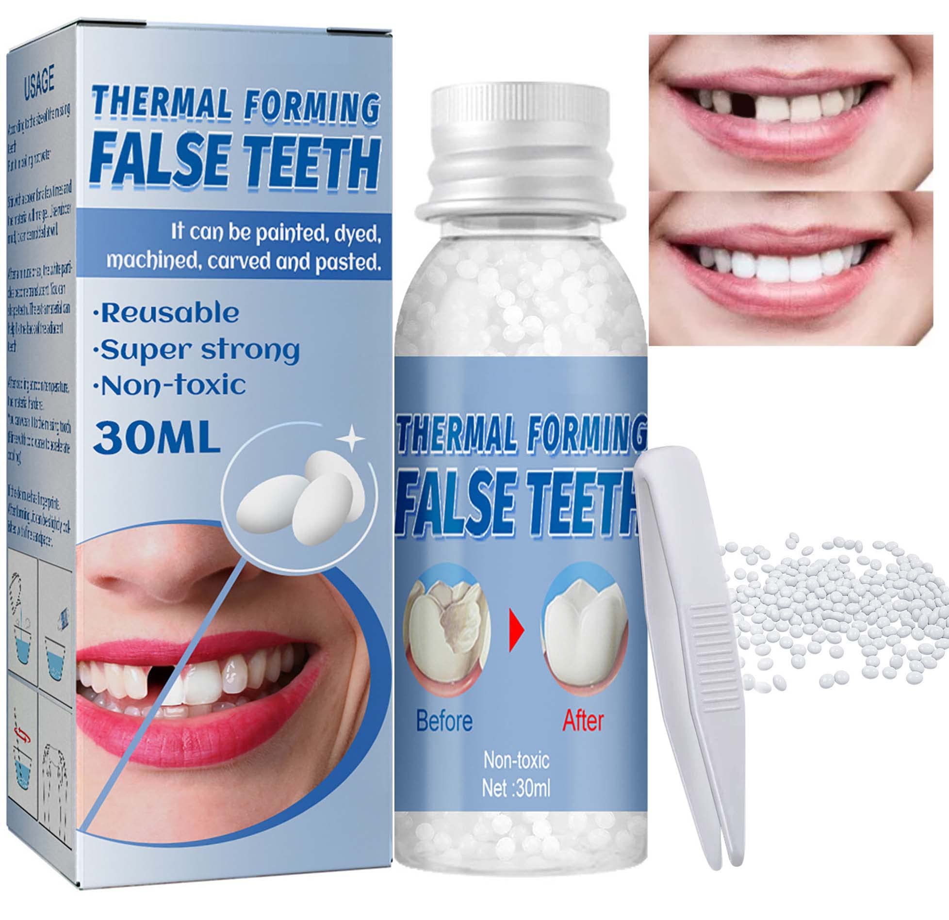 Tooth Repair Kit, Temporary Teeth Replacement Kit, Temporary Teeth Filling Repair Kit