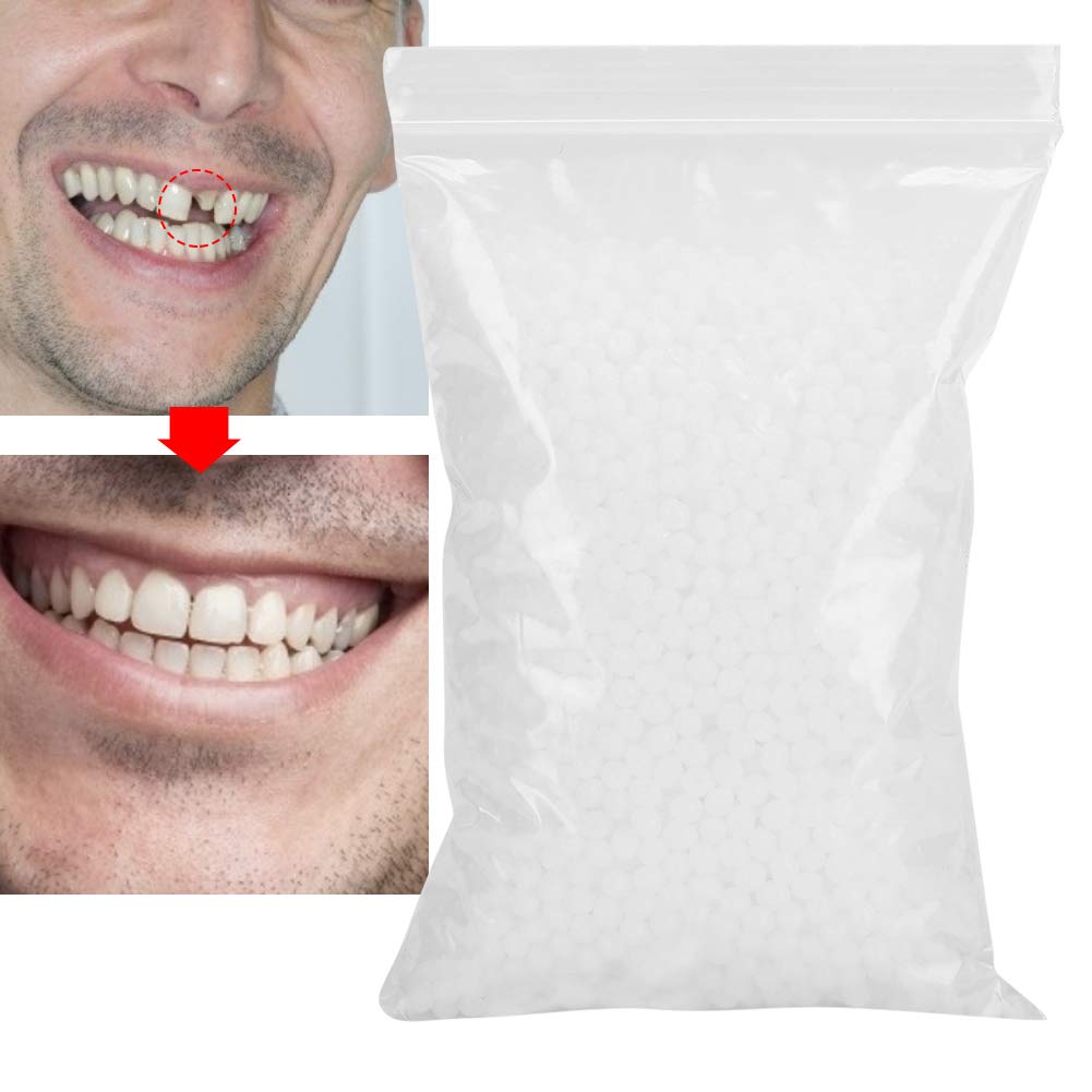 Tooth Repair Kit,Temporary Teeth replacement kit Temporary Tooth Repair Beads for Missing Broken Teeth Dental Tooth Filling Material(100g)