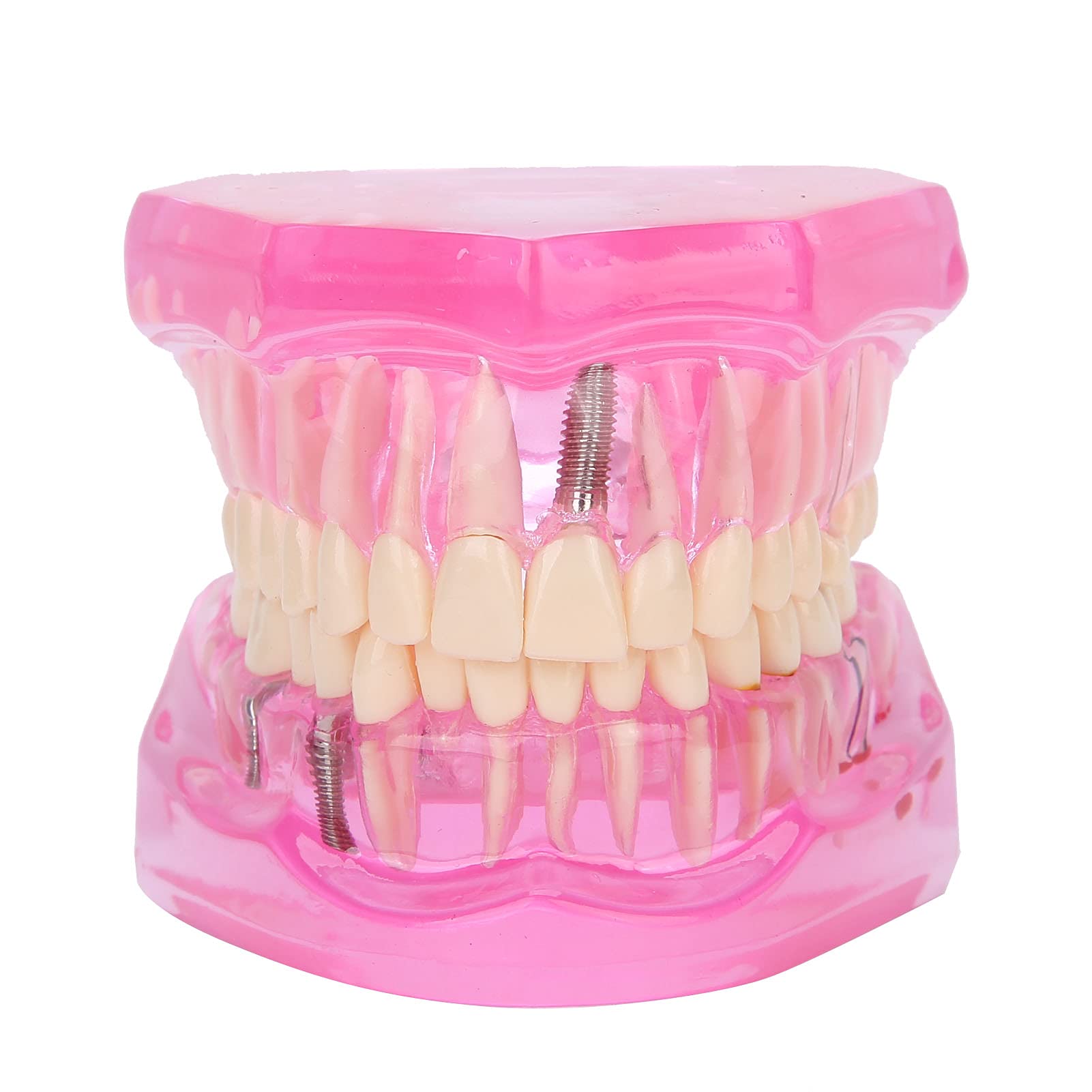 Transparent Adult Teeth Model ,Pathological Removable Teach Repair Studying Dental Teaching Tools Standard Size