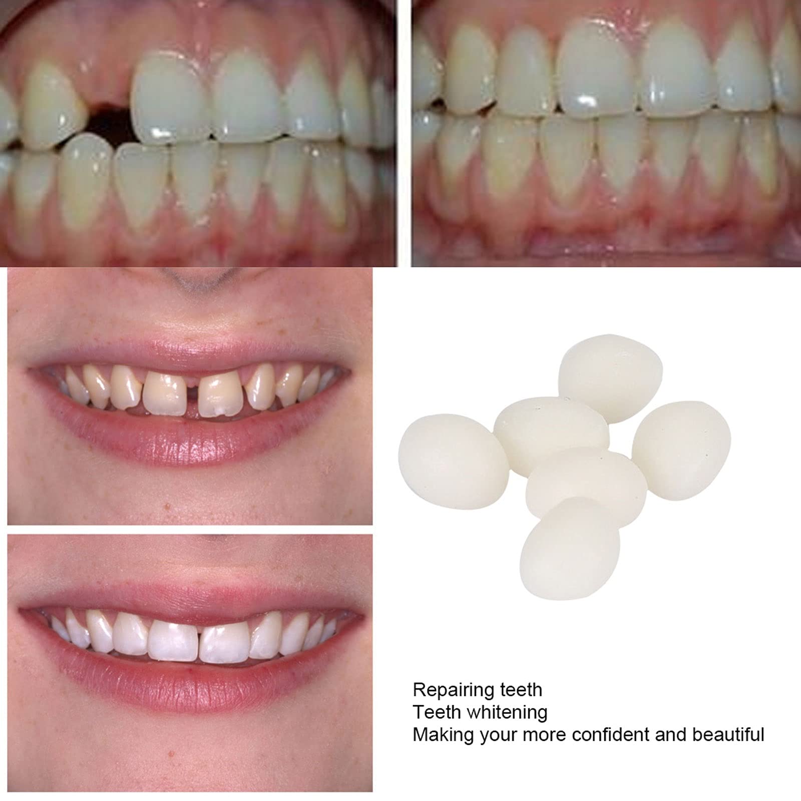 Temporary Tooth Repair Gaps, 30g False Teeth Solid Glue, Filling Denture Adhesive, Teeth Care Tool, Dental Gaps Filling for Temporary Cover, for The Missing Broken and Deformity Teeth Improve Smile (