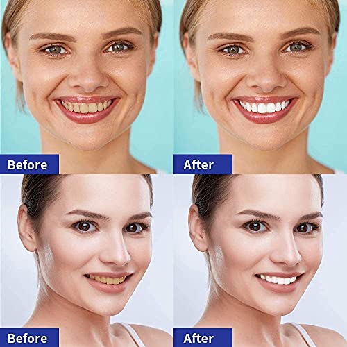 Teeth Whitening Strips, Non-Sensitive Teeth Whitening Kit 14 Sets Teeth Whitener for Tooth Whitening, Aids in The Removal of Smoking, Coffee, Soda, and Wine Stains