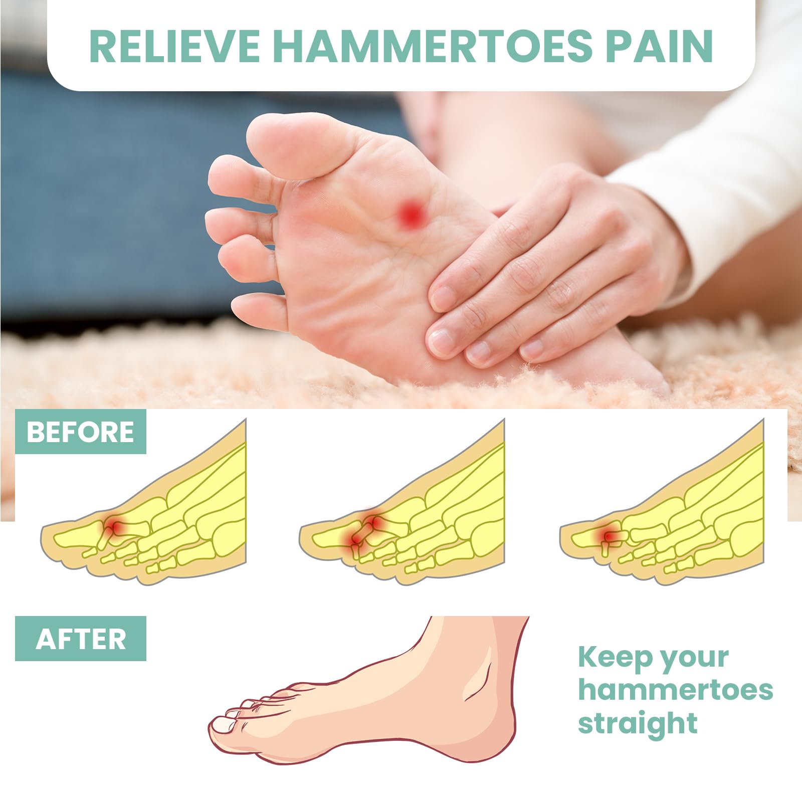 Welnove Hammertoe Corrector Gel Toe Straighteners - 8 Pcs Toe Support Pads Cushion - Realign Bent, Crooked, Curled, Claw, Hammer Toes - Firm Support