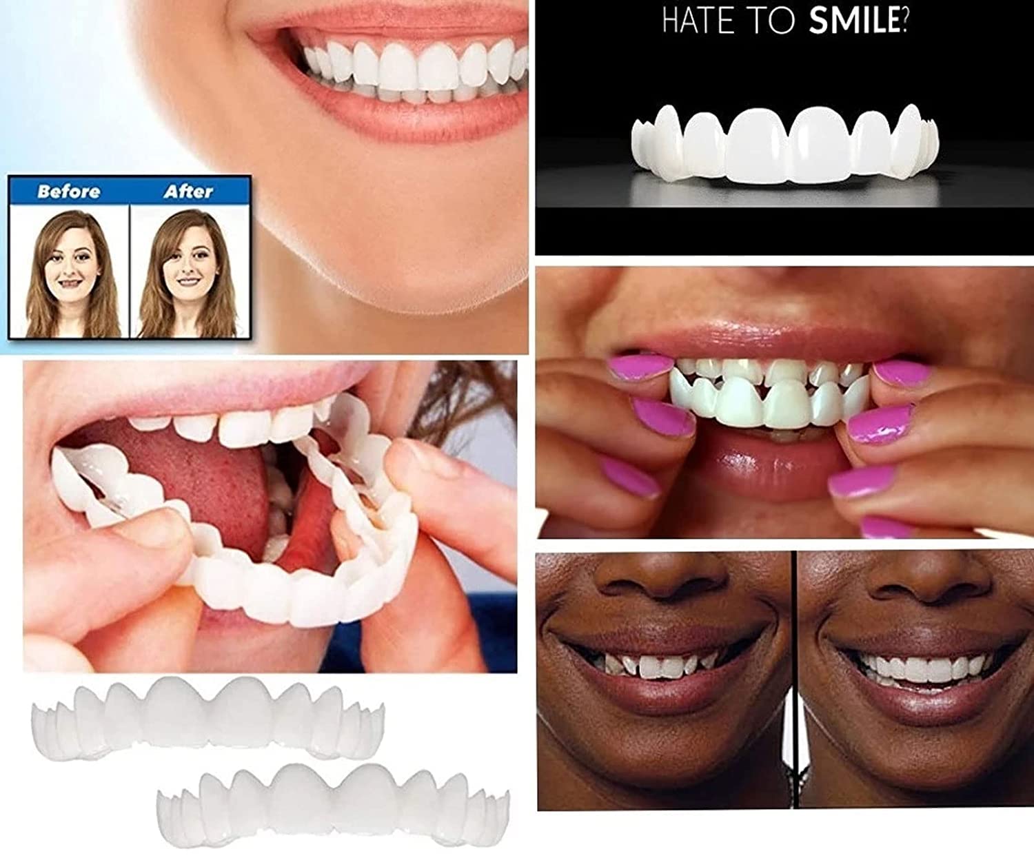 Upper and Lower Veneer, Dentures for Women and Men, Fake Teeth, Natural Shade! Fix Your Smile at Home Within Minutes!