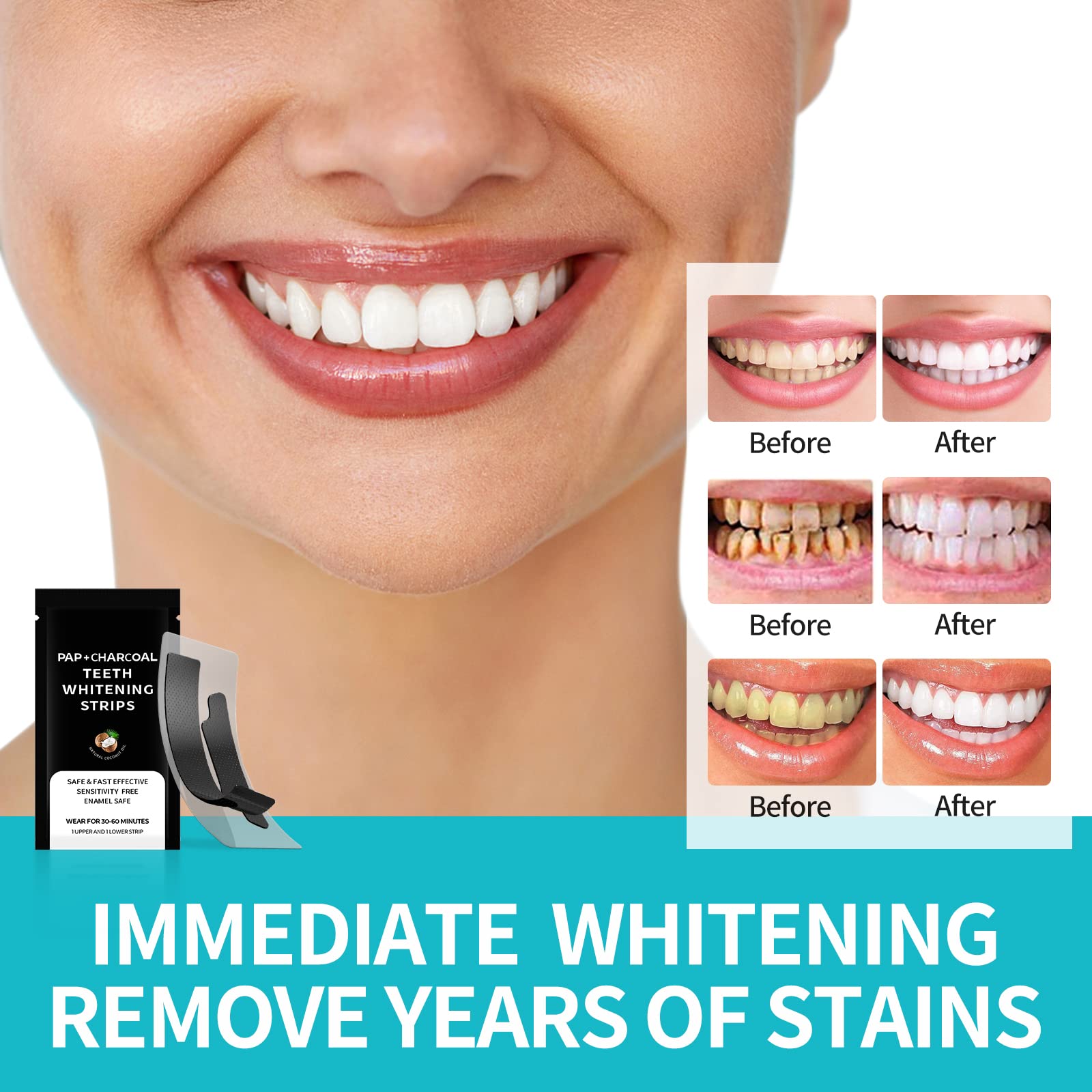 Teeth Whitening Strips for Teeth Sensitivity Free, Professional Teeth Whitening Strips kit, 14 Treatments with 28 Dental Whitener Strips, Mint Flavor
