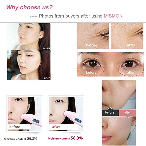 MiSMON High Frequency Facial Machine LED Light Theraphy Skin Tightening Device for Face, 5 in 1 Multifunctional Facial Massager for Wrinkle and Acne Removal