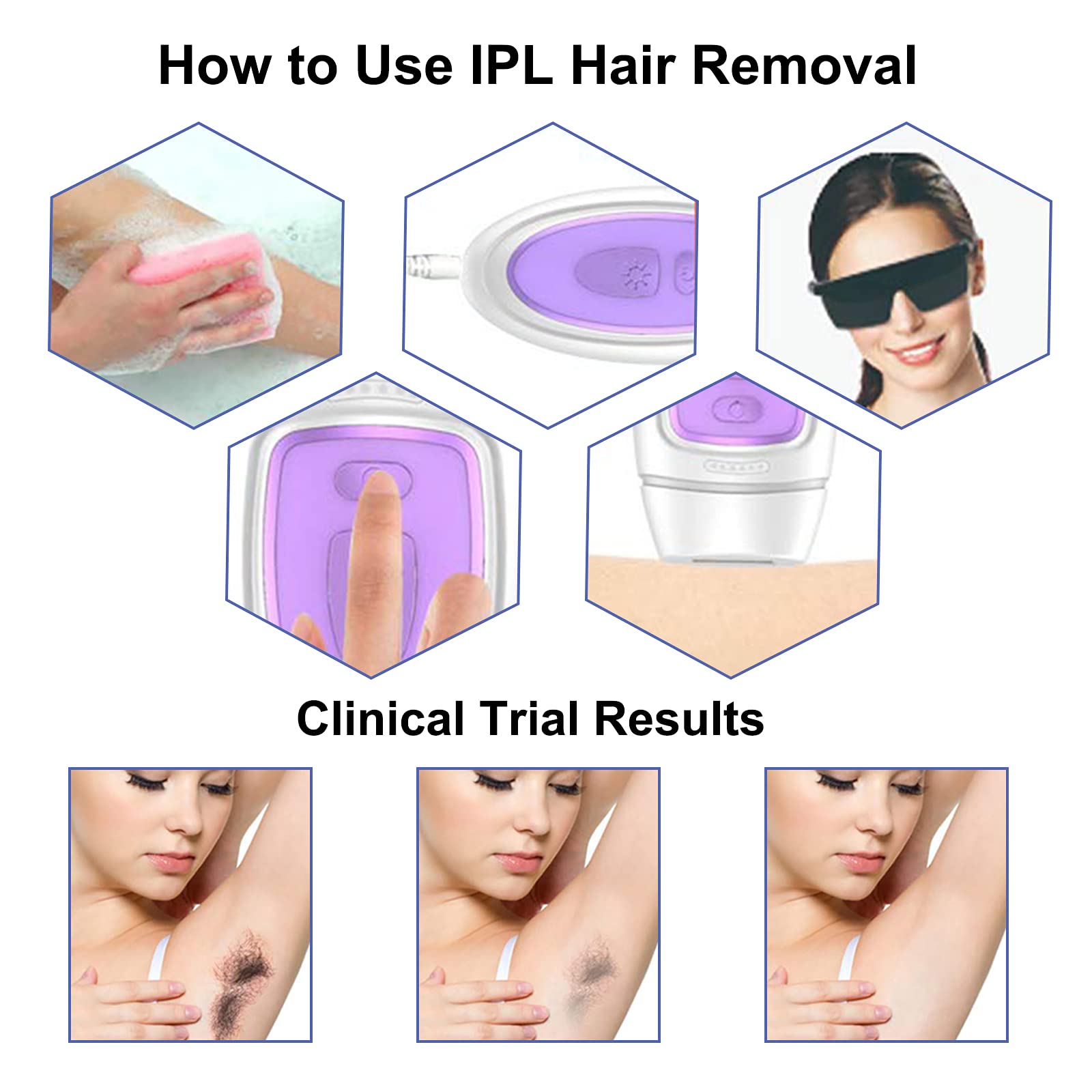 Laser hair removal for Women,Permanent Hair Removal Device with 999900 flashes. (purple)
