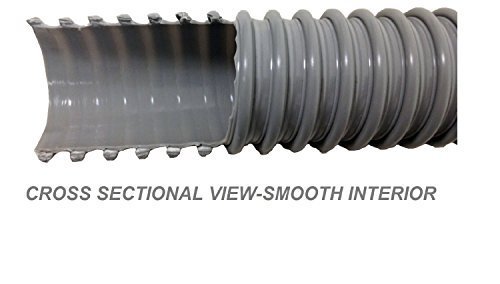 Snappy Trap 1 1/2" All-In-One-Drain Kit for Double Bowl Kitchen Sinks