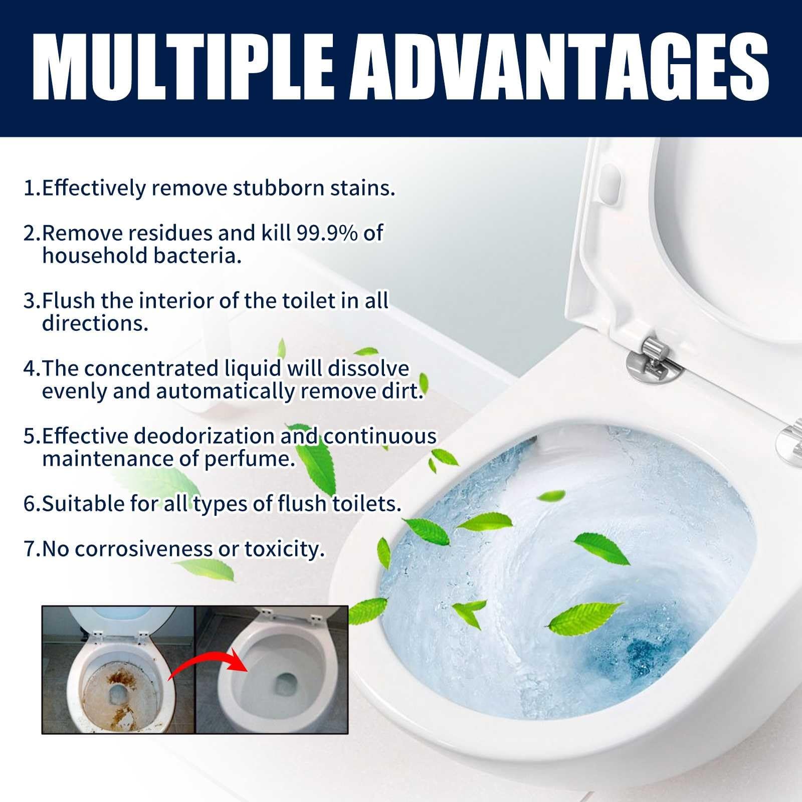 Koranor Toilet Cleaning Solution Toilet Toilet Descaling And Cleaning Stains And Odor Removal Cleaning Solution 100ml Fabric Pilling (Sky Blue, One Size)