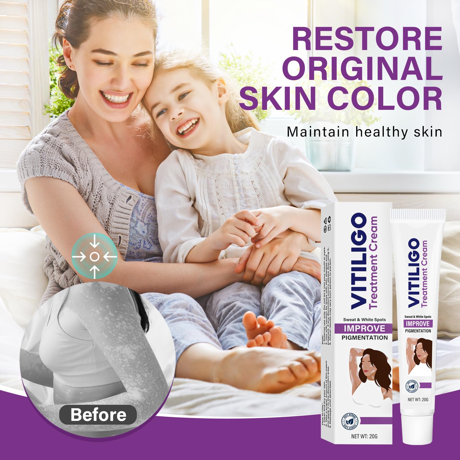 Xshows Vitiligo Cream, Vitiligo Treatment for Reduce White Spots and Improve Skin Pigmentation (Packaging May Vary)
