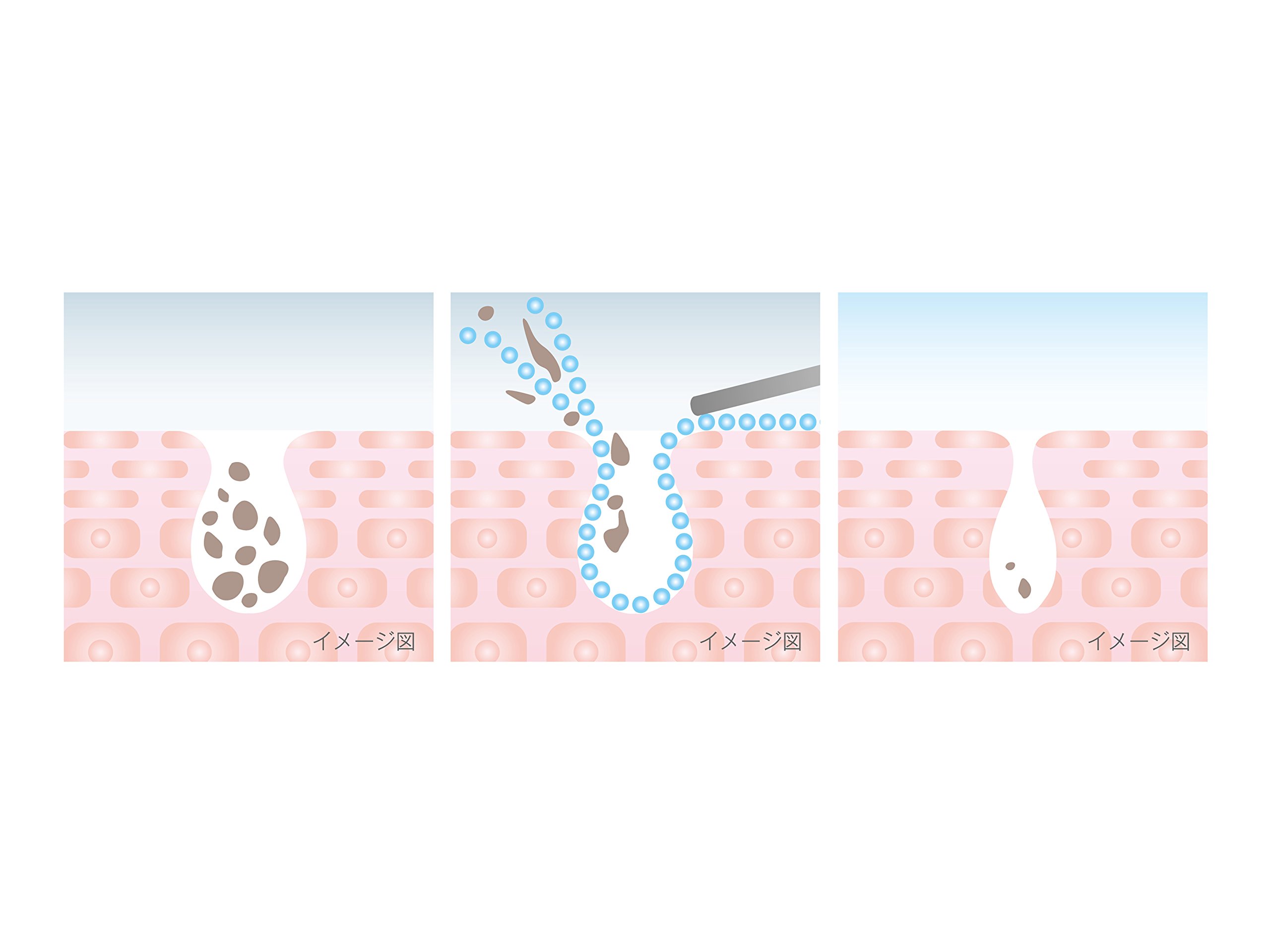 KOIZUMI Bijouna [horny pores care ultrasonic peeling KBE-2700 / P