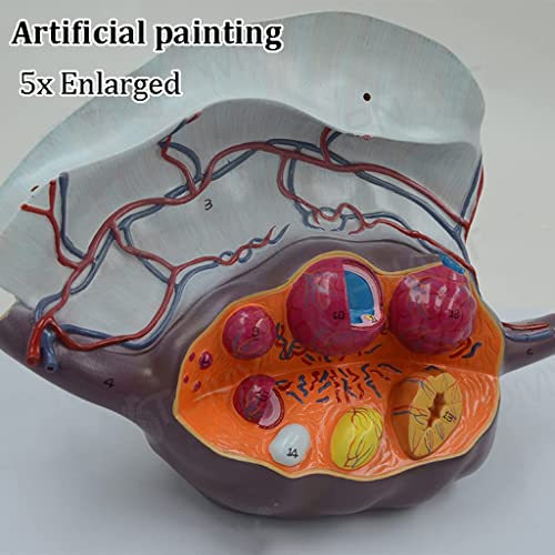 VNABO Removable Medical Model Female Reproductive System Anatomical Model Female Uterus and Ovary Structure Model Human Organ Model