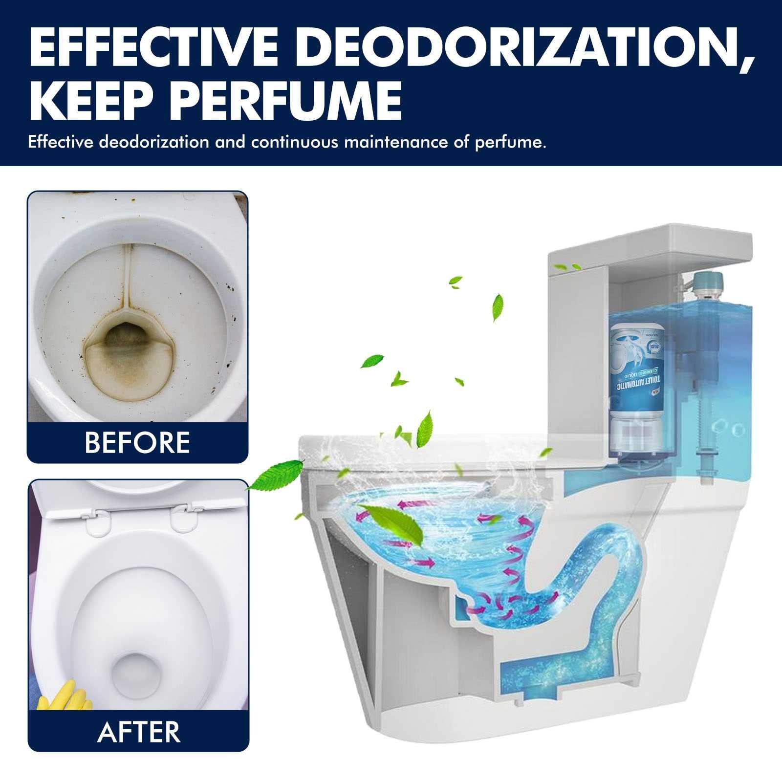 Koranor Toilet Cleaning Solution Toilet Toilet Descaling And Cleaning Stains And Odor Removal Cleaning Solution 100ml Fabric Pilling (Sky Blue, One Size)