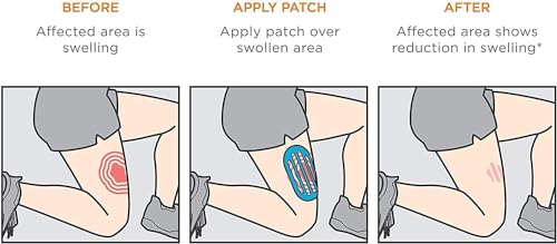 KT Tape Recovery+ Patch, Swelling and Inflamation Relieft