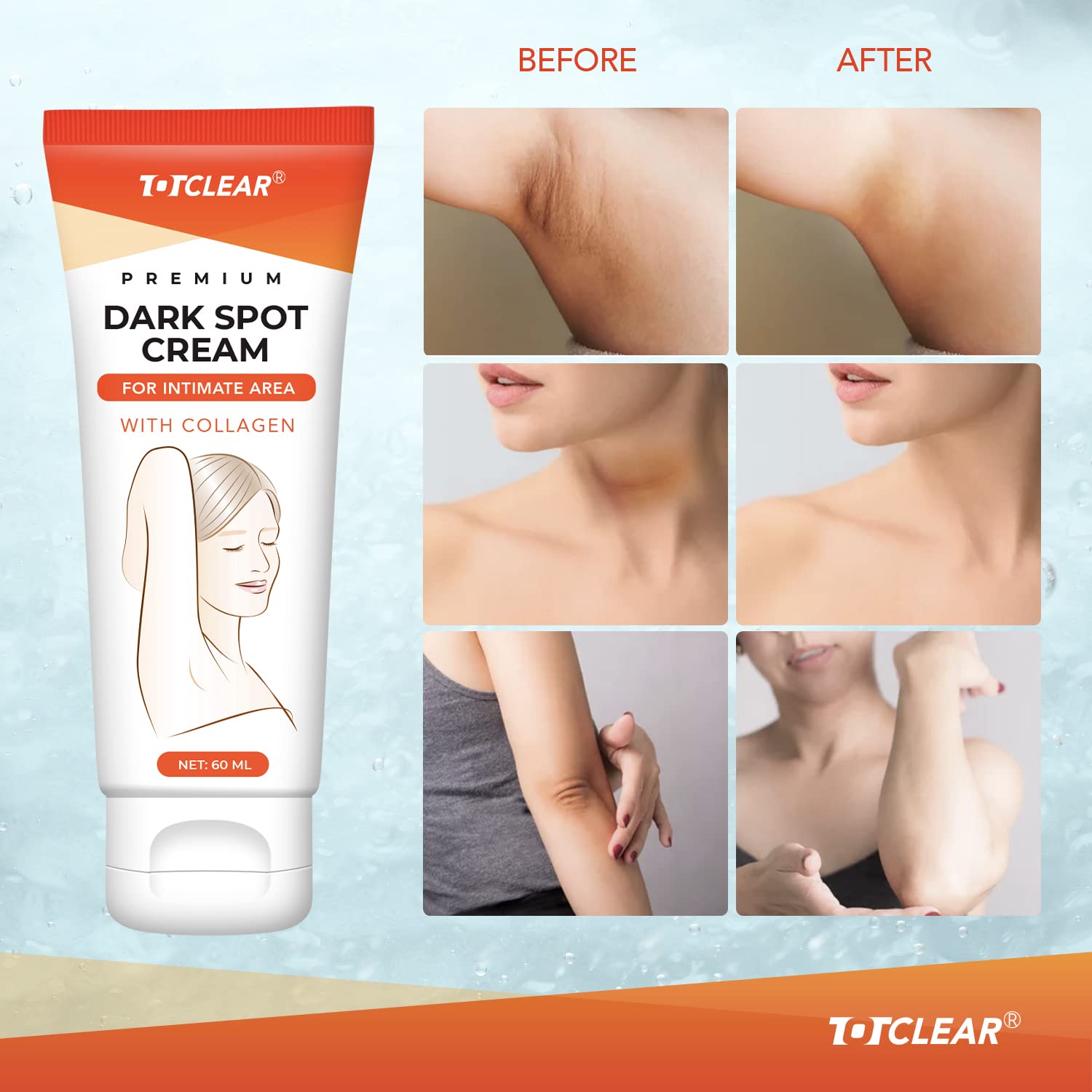 TOTCLEAR Dark Spot Remover for Face, Underarm Cream, Armpit, Neck, Back, Legs, Elbows, Private Areas, Quality Plant-Based Ingredients,Intimate Areas,60ML