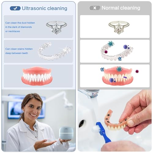 Voraiya®Ultrasonic Cleaner for Dentures,Jewelry,Aligner,Retainer,Dental Mouth Guard,Whitening Trays,Denture Cleaner,Ultrasonic Cleaning Machine, 5 Minute Automatic Timed Shutdown (Type A - Green)