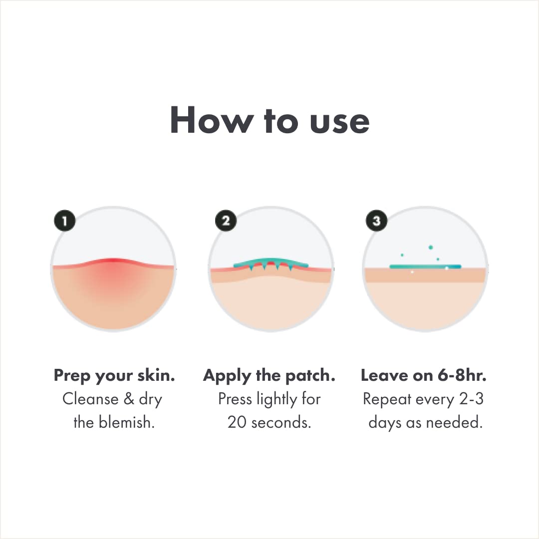 Mighty Patch Micropoint for Blemishes from Hero Cosmetics - Hydrocolloid Acne Spot Treatment Patch for Early Stage Zits and Hidden Pimples, 395 Proprietary Micropoints (6 Patches)