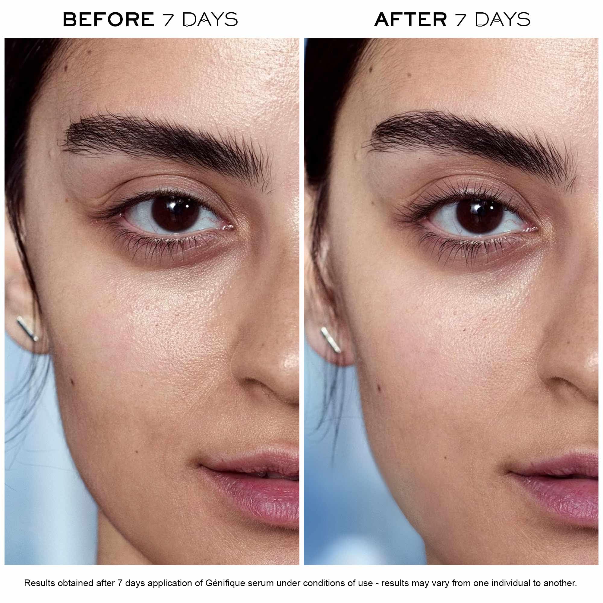 Lancôme Advanced Génifique Radiance Boosting Anti-Aging Face Serum - Visibly Hydrates & Plumps Skin - with Bifidus Prebiotic, Hyaluronic Acid & Vitamin Cg, 1 Fl Oz