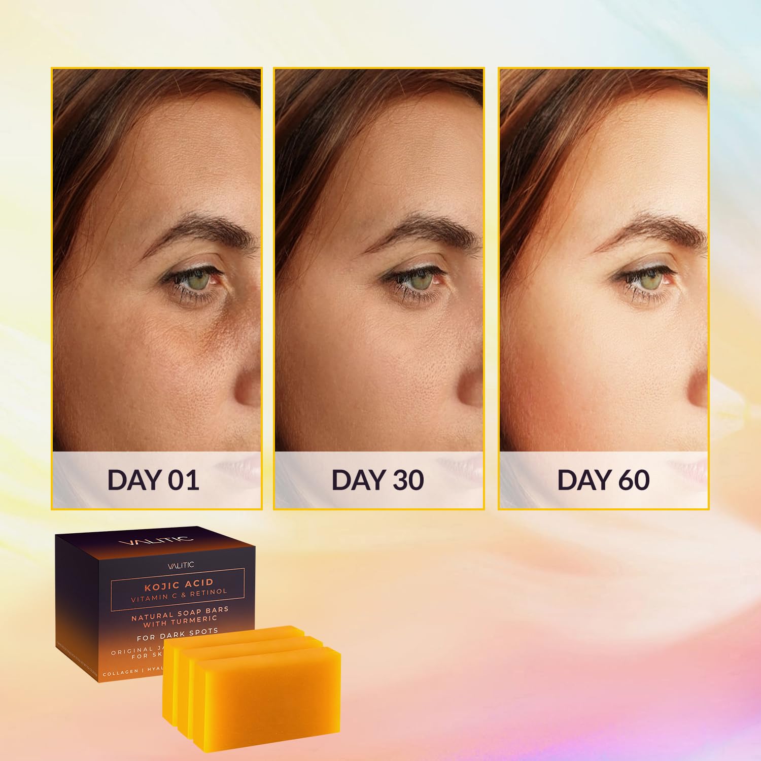 VALITIC Kojic Acid Vitamin C and Retinol Soap Bars with Turmeric for Dark Spot - Original Japanese Complex Infused with Collagen, Hyaluronic Acid, and Vitamin E (3 Pack)