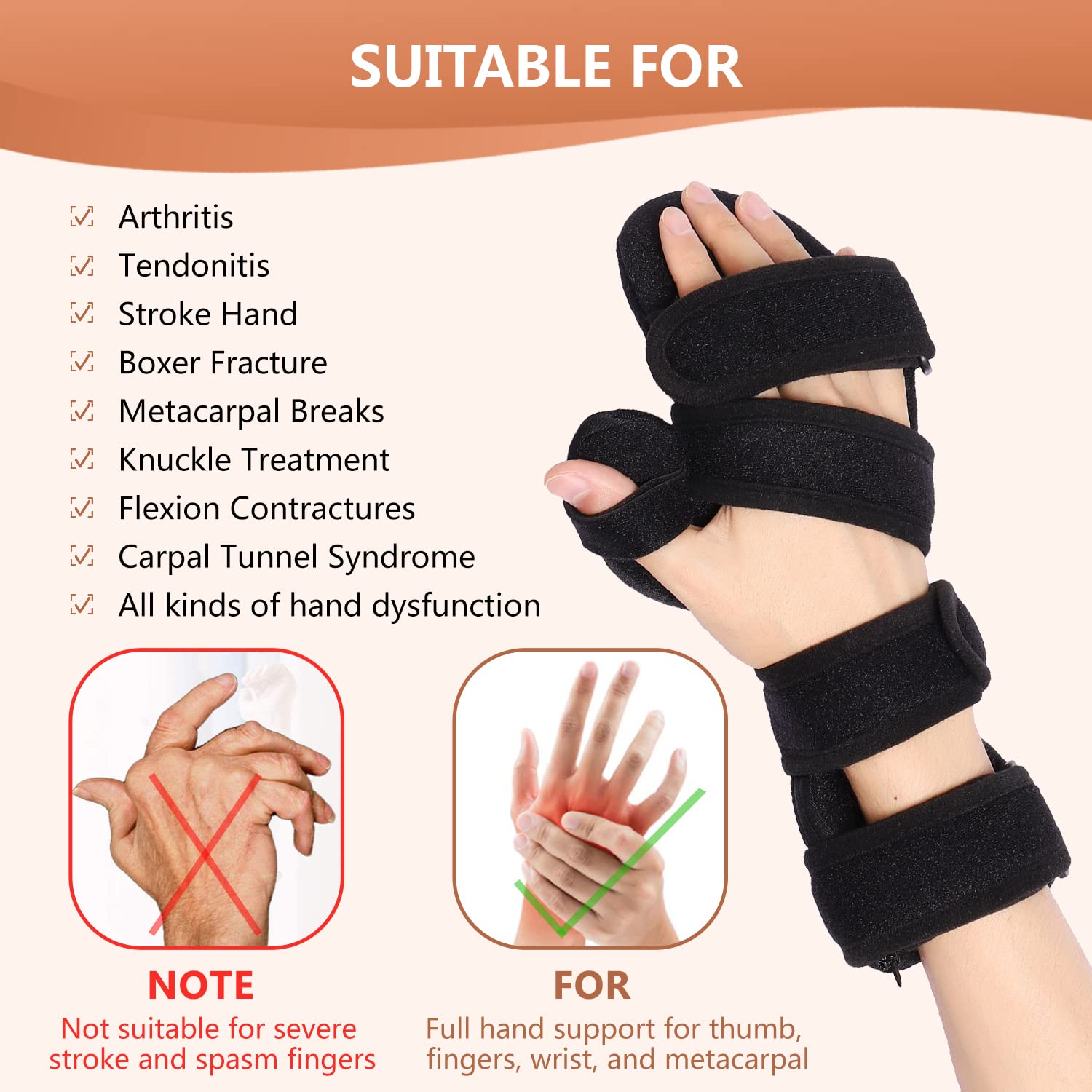 Scurnhau Resting Hand Splint, Hand Brace with Finger Support, Night Immobilizer for Finger Contractures, Broken Hand, Stroke Patients, Carpal Tunnel, Metacarpal Break, Arthritis, Muscle Atrophy
