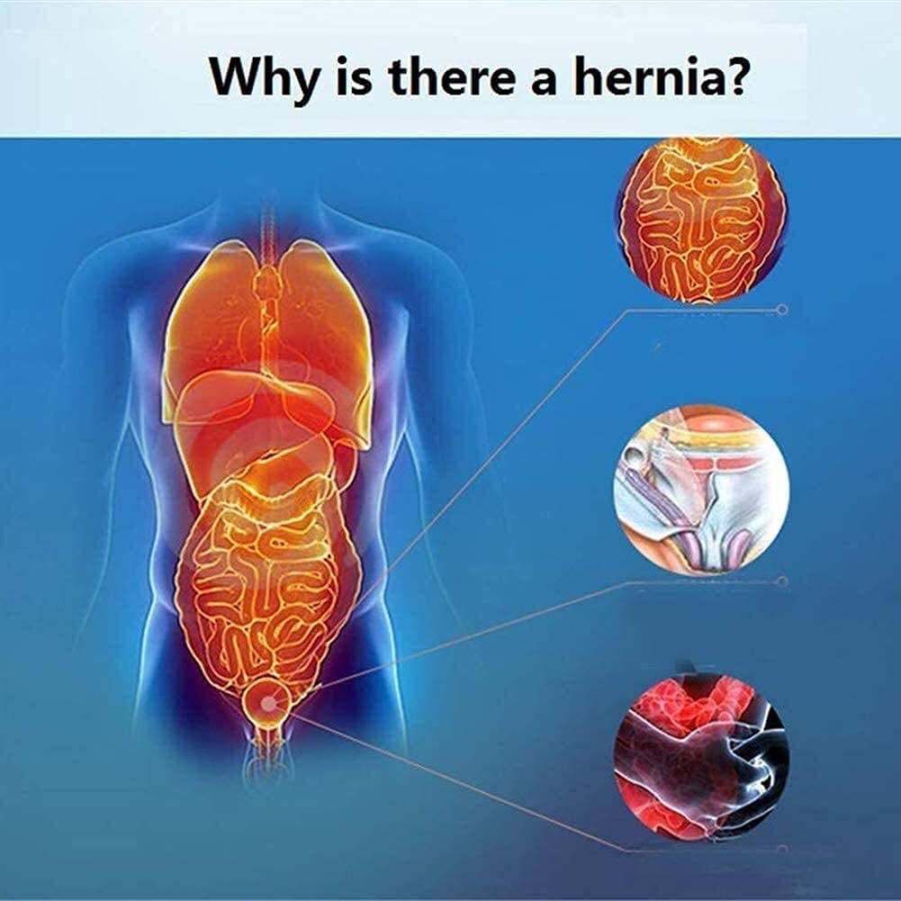 SoGuDio Hernia Belt Hernia Support Truss for Double Inguinal or Sports Hernia Adjustable Groin Straps Surgery& Injury Recovery Hernia Belt (Size : Medium)